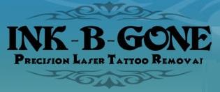 Map and Directions to Ink-B-Gone Precision Laser Tattoo Removal in ...