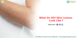 What Do HIV Skin Lesions Look Like? | Safehealths in O Fallon, IL 62269