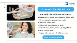 Cosmetic Dentist St Louis | Stallings Dental in Saint Louis, MO 63128