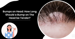 Bumps on Head: How Long Should a Bump on The Head be Tender? | The ...